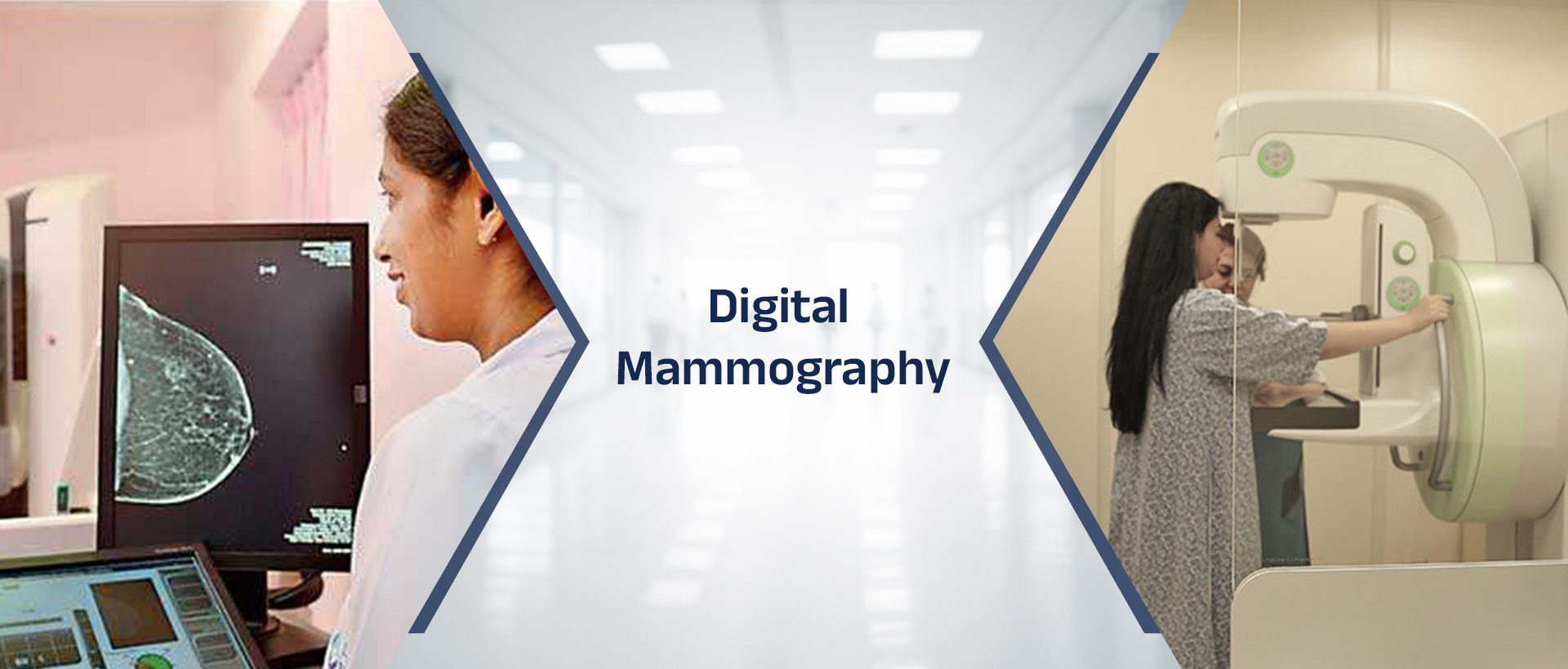 Digital Mammography