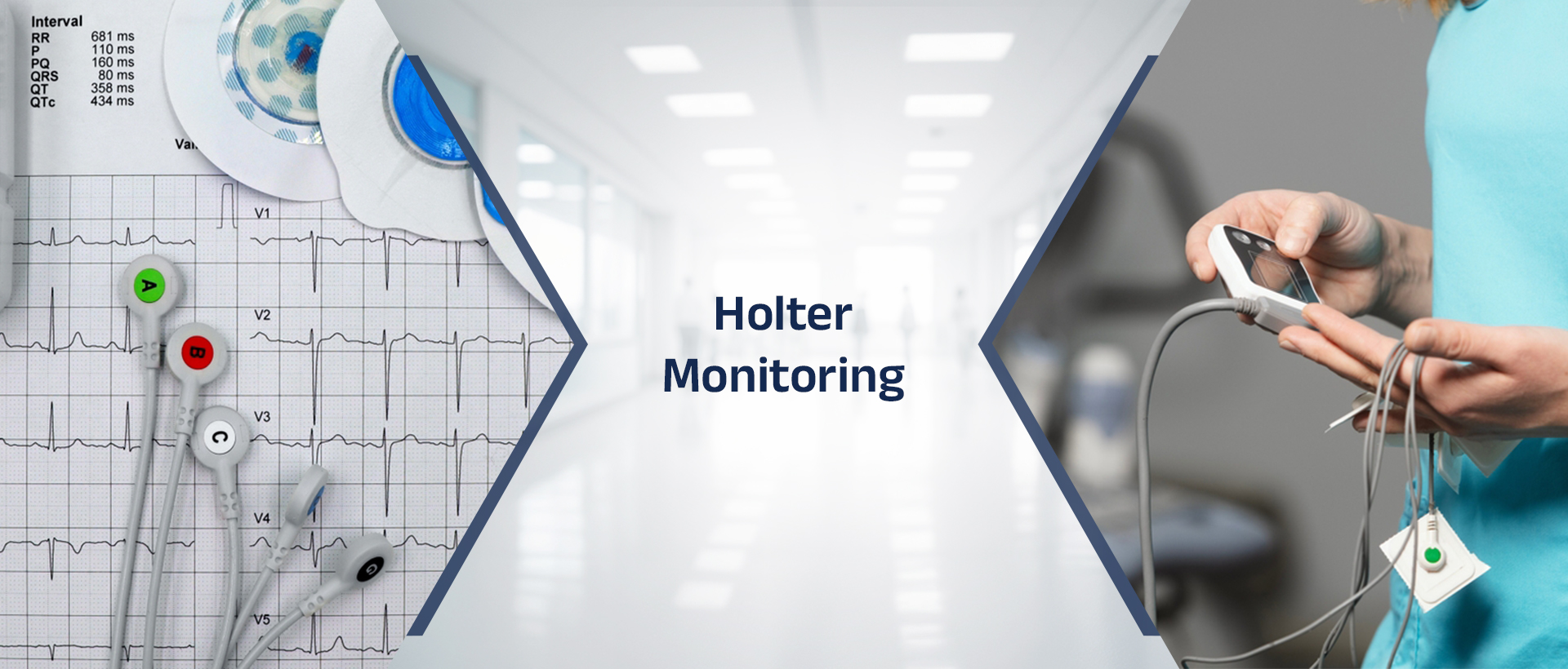 Holter Monitoring