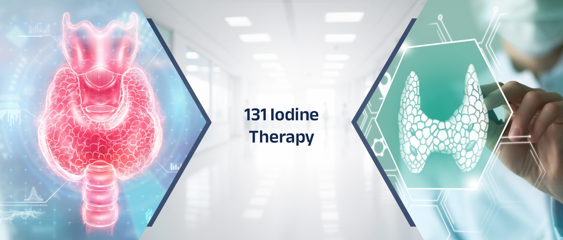 131 IODINE Therapy