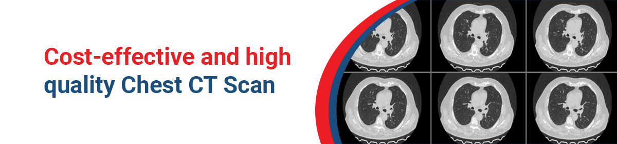 Chest CT Scan in Kolkata: Where to Find the Best Cost and Quality