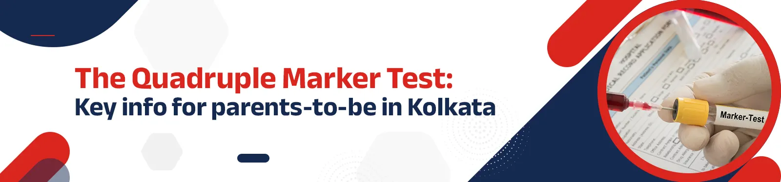 The Quadruple Marker Test in Kolkata: What Expecting Parents Should Know
